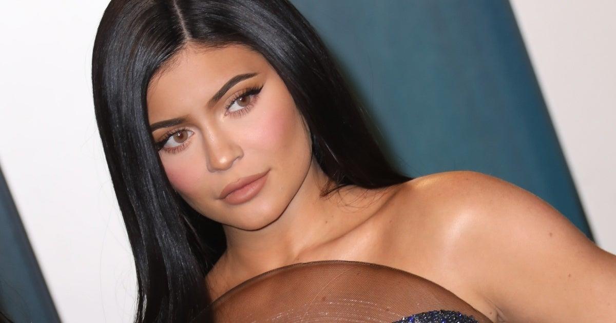 Kylie Jenner Divides Fans With 'Blistered, Shiny Fungus Infection ...