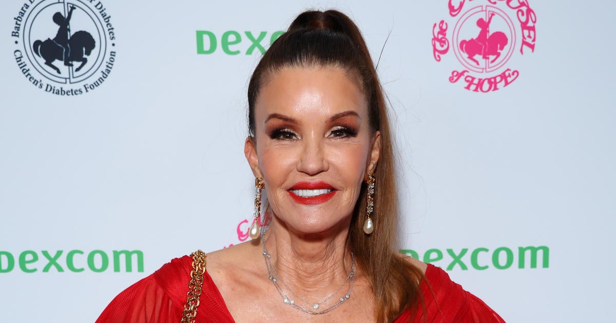 Janice Dickinson Hospitalized After 'Horrific Head Injuries,' Report Says