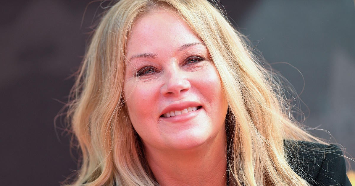 Christina Applegate Has 30 Lesions On Her Brain Amid Ms Battle