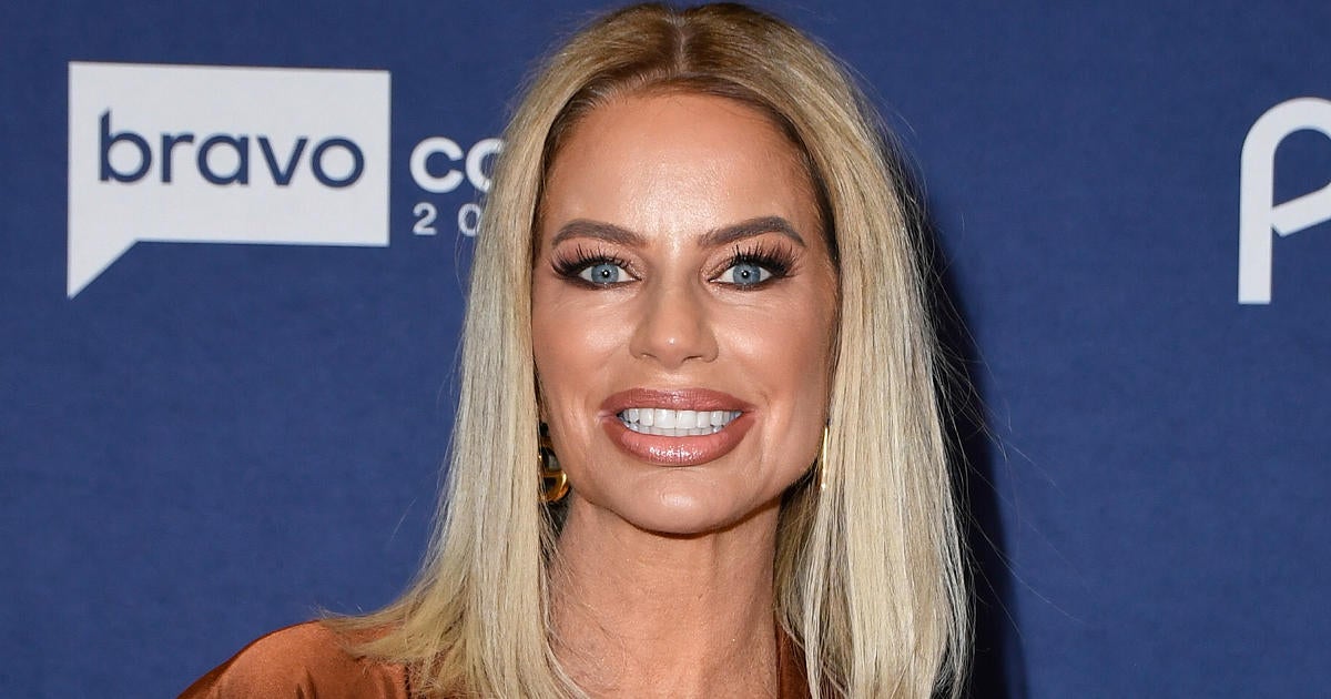 Caroline Stanbury Documents Her Facelift, Husband Tears up at Her Post ...