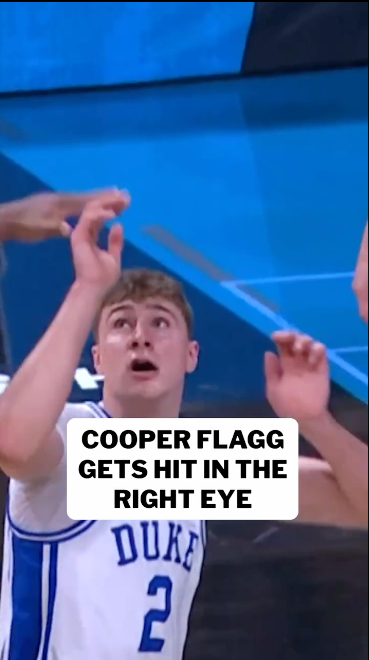 Cooper Flagg got hit in the eye Stream of General Videos - CBSSports.com