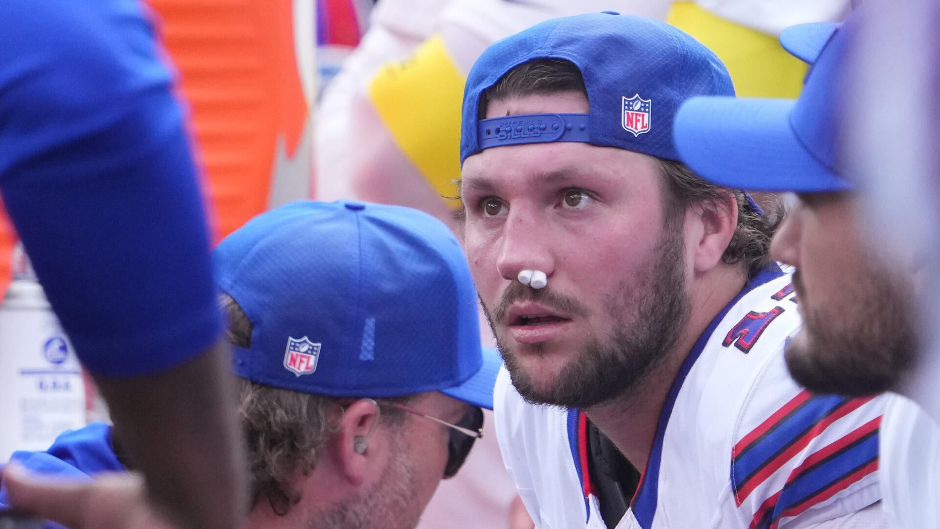 Josh Allen Likely to Wear Visor to Protect Nose Stream of National ...