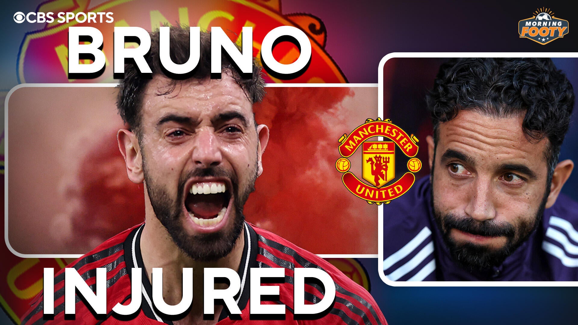 Bruno Fernandes INJURED, will Kobbie Mainoo STEP UP for Manchester ...