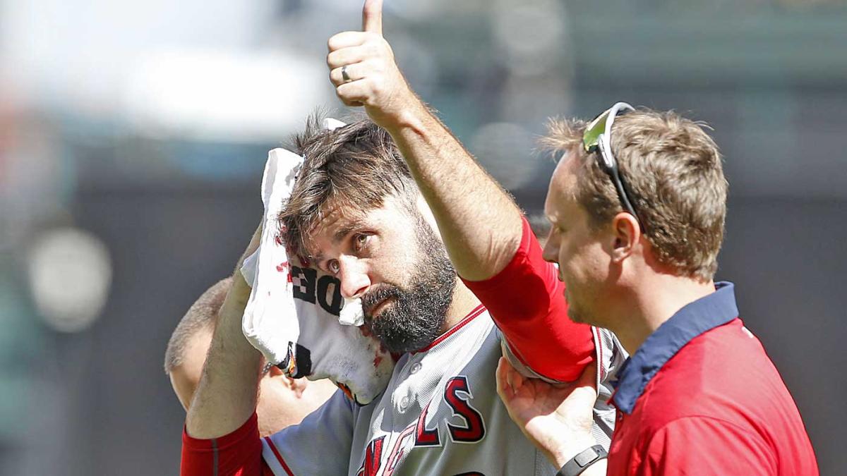 Angels' Shoemaker needed emergency surgery after being struck by line ...