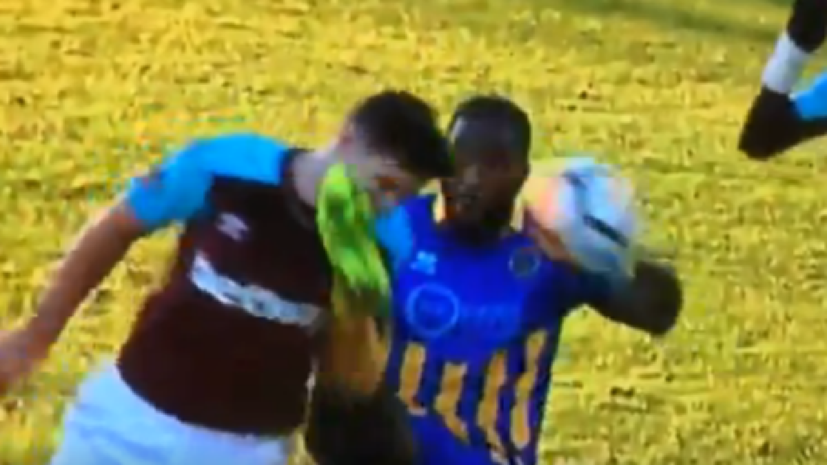 WATCH: Soccer player loses tooth after kick to the face during FA Cup ...