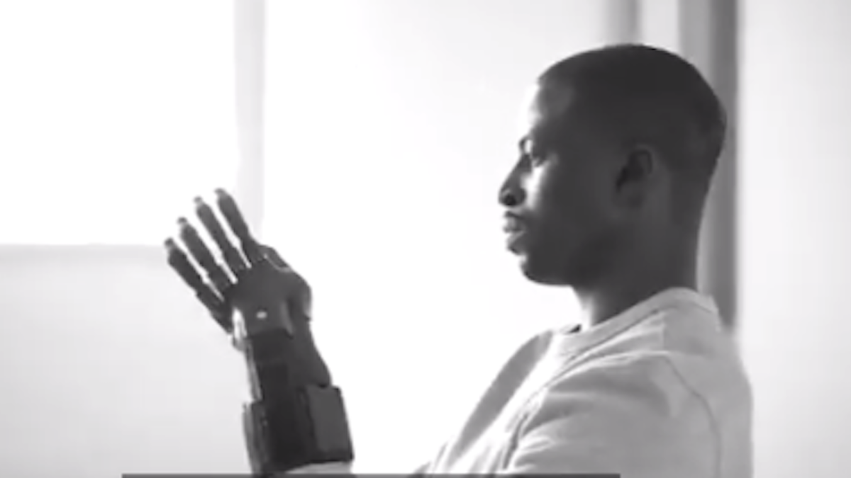 Ex-Browns receiver has hand amputated; waited 10 months to share ...